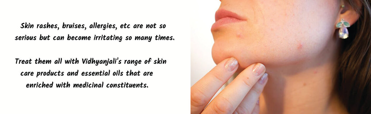 Skin Rashes/Allergies — Vidhyanjali